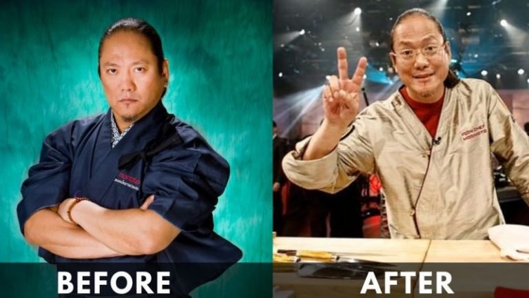 Renee Zellweger Weight Loss [2024]: Before and After