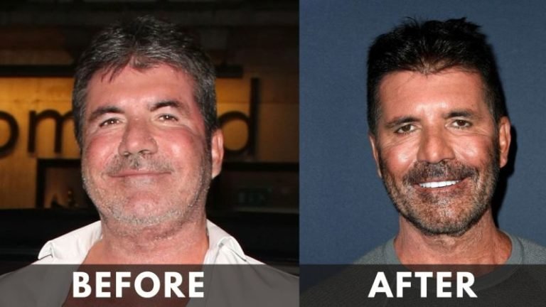 Simon Cowell Weight Loss: [2024] Before and After